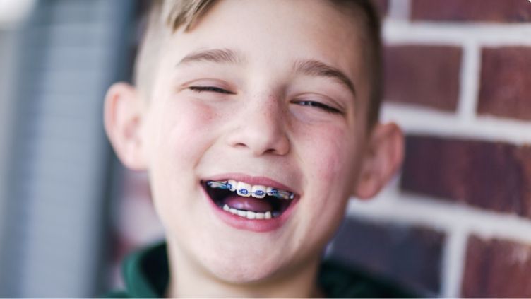 Orthodontic Cover | Dental Treatments & Braces | Bupa